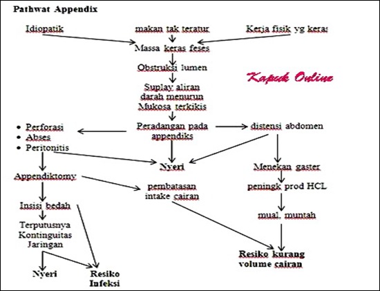 APPENDIXCITIS | Askep Free